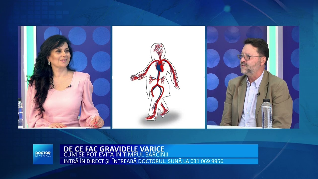 Doctor Medika! VASE DE SANGE SPARTE, VARICE, cu dr. STEFAN JIANU ...